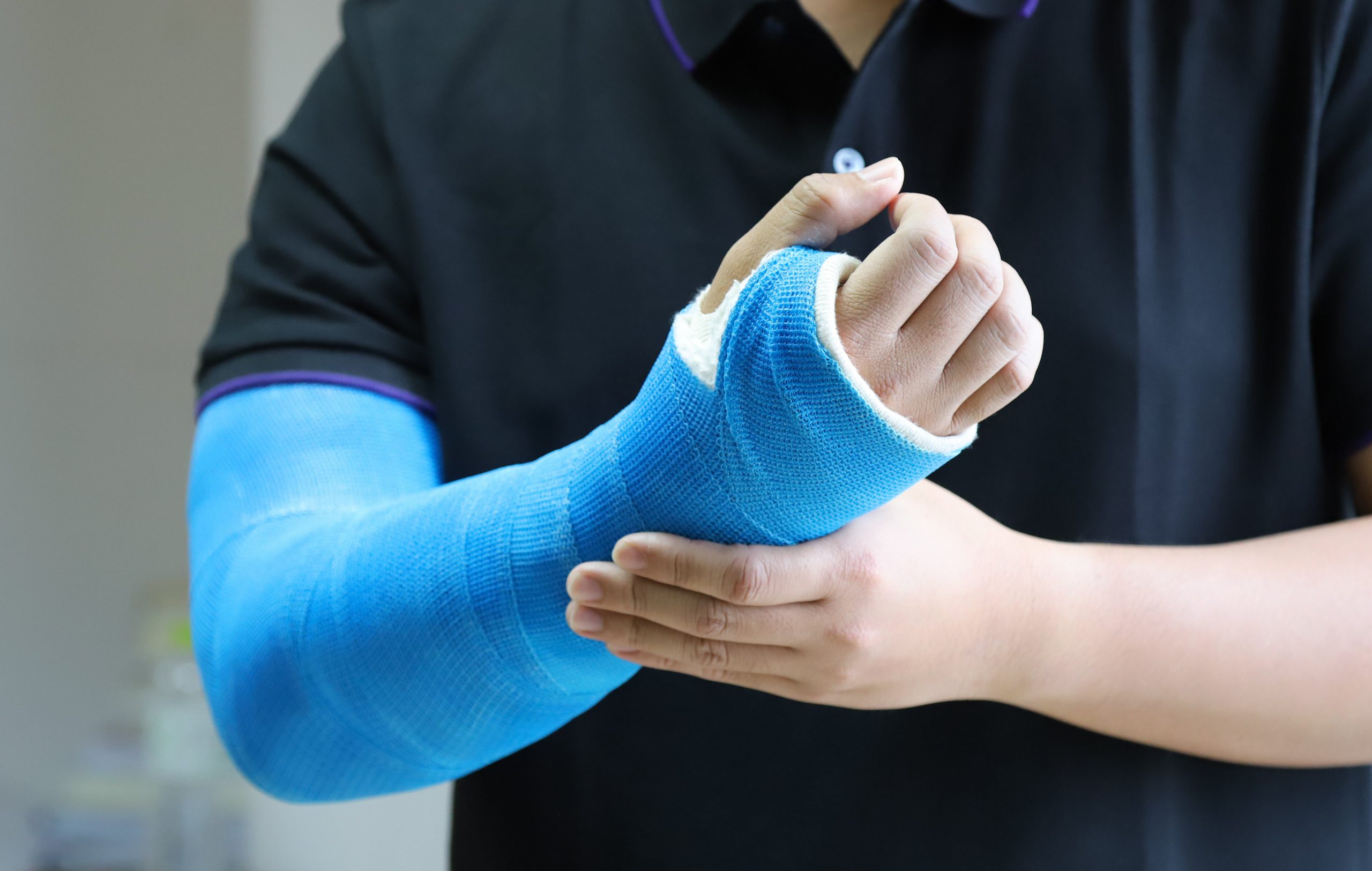 Waterproof Synthetic Casting | Pontifex Physiotherapy